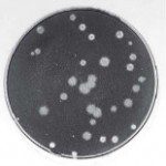 Detecting viruses: the plaque assay | Virology Blog