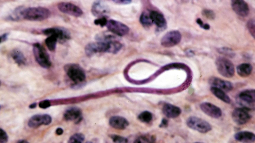 TWiP 24: Onchocerca volvulus, a vector-borne, filarial nematode